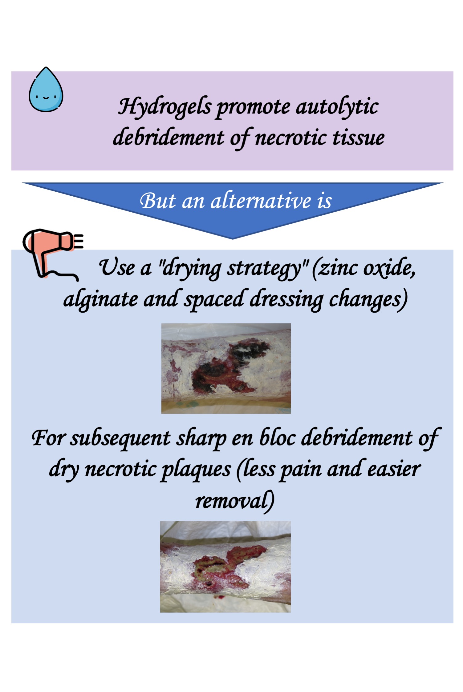 drying necrosis - Elena Conde Montero
